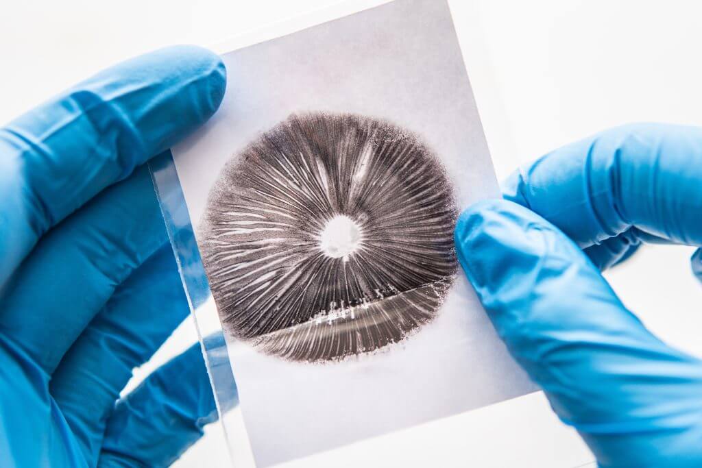 Spore Syringe Colonization Vs. Liquid Culture: What’s Faster